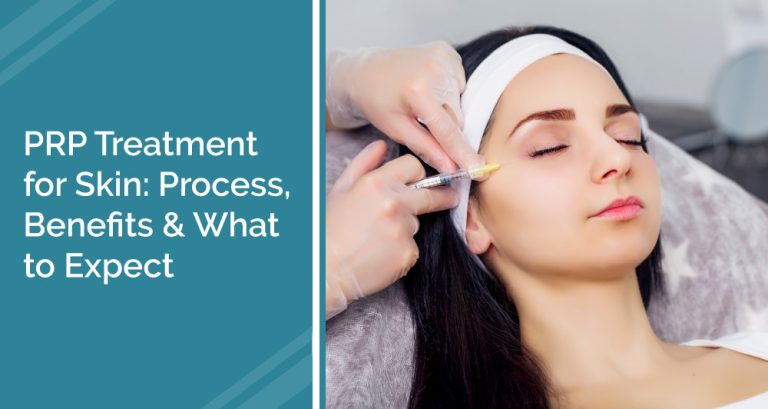 PRP Treatment for Skin: Process, Benefits & What to Expect